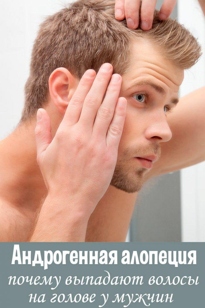 Алопеция у мужчин: причины и лечение, средства от облысения ...